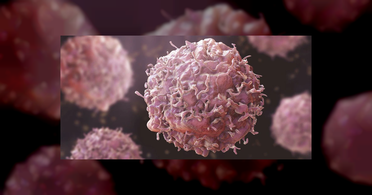 Artificial intelligence in cancer treatment - Bartaman Patrika